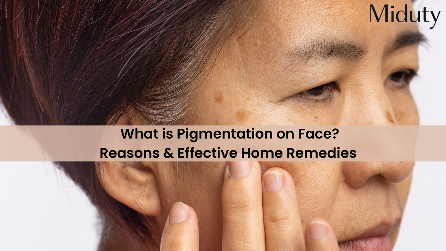 Pigmentation on Face | Reasons & Home Remedies - Miduty